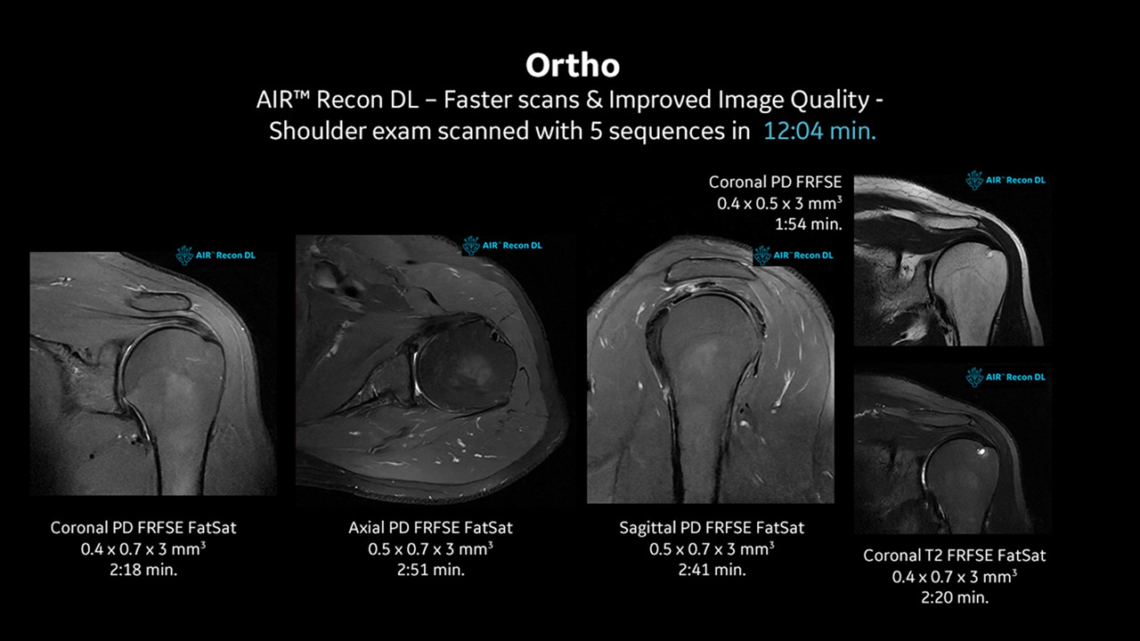 SIGNA™ Creator 1.5T MRI scanner - mit