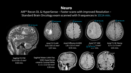 SIGNA™ Creator 1.5T MRI scanner - mit